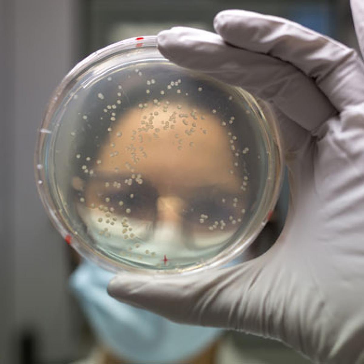 Genethon launches a pivotal clinical trial in Europe for treatment of ...