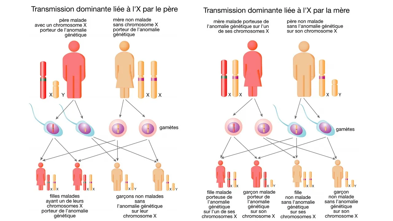Transmission génétique dominante liée au chromosome X | AFM Téléthon
